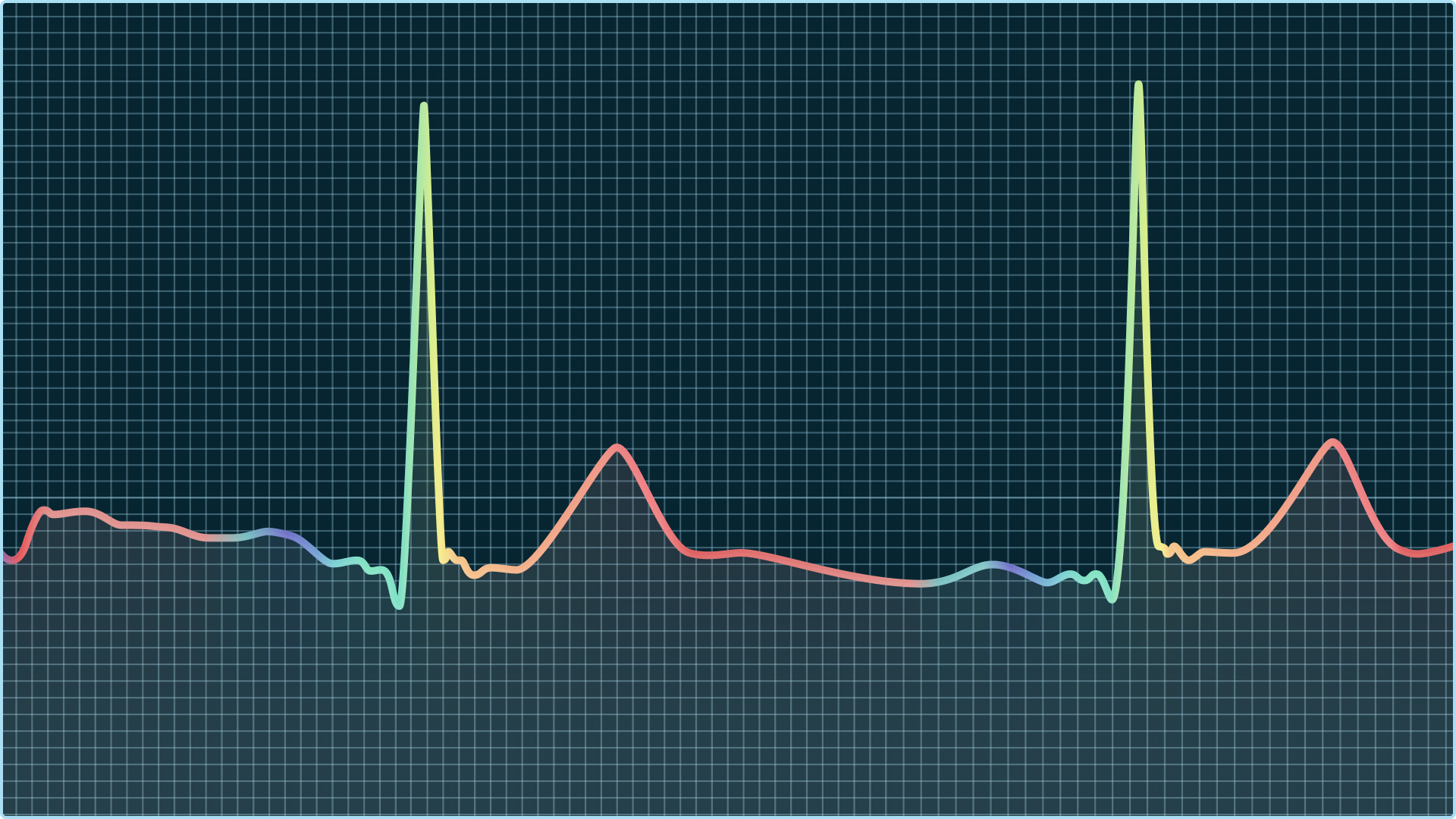 QALY | How to Measure PR, QRS, and QTc Intervals from Your Watch ECG